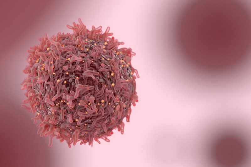 Soft Tissue Tumors: 10 Important Things You Need To Know | Advanced ...