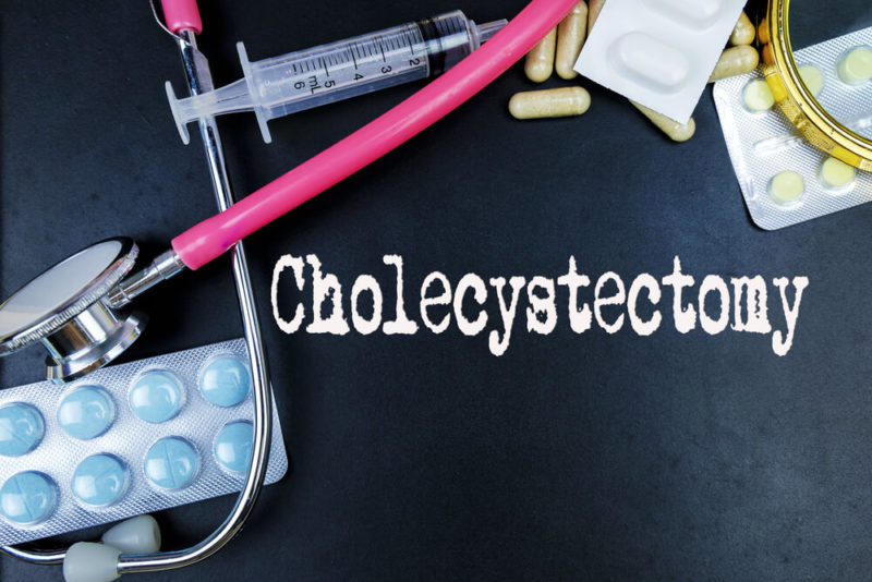 Laparoscopic Cholecystectomy and Its Advantages | Advanced Surgical ...