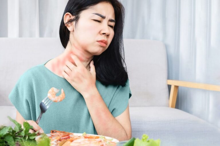 Shellfish Allergy: Symptoms and Causes | Allergy & Immunology Center