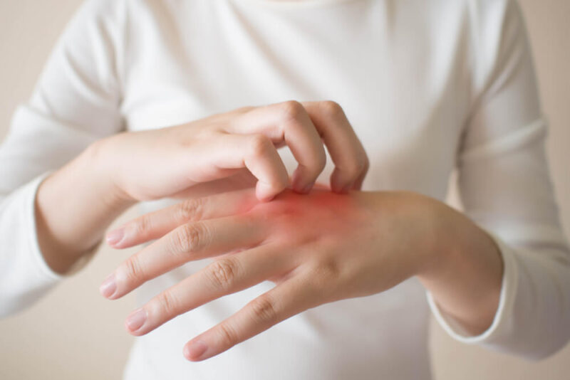 How To Get Rid Of A Rash At Home | Allergy & Immunology Center