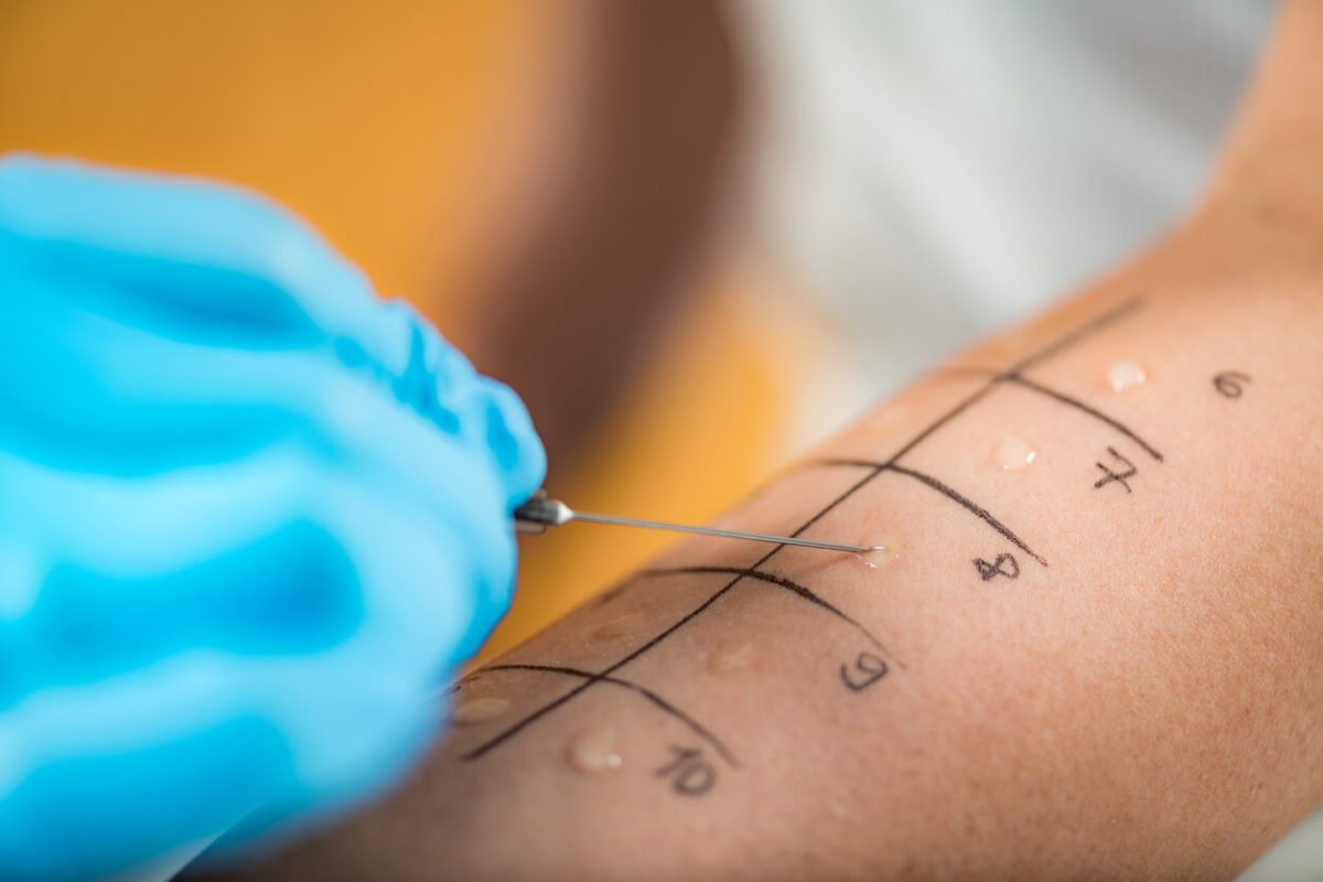 Everything You Should Know About Allergy Testing | Carreras Medical Center