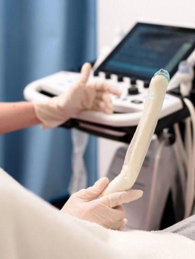 Vaginal & Transabdominal Ultrasound | Doral Beach Gynecology