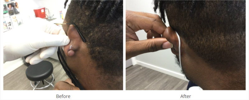 Gallery | Green Dermatology