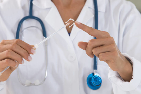 What Are The Main Reasons For and What To Expect After IUD Removal ...