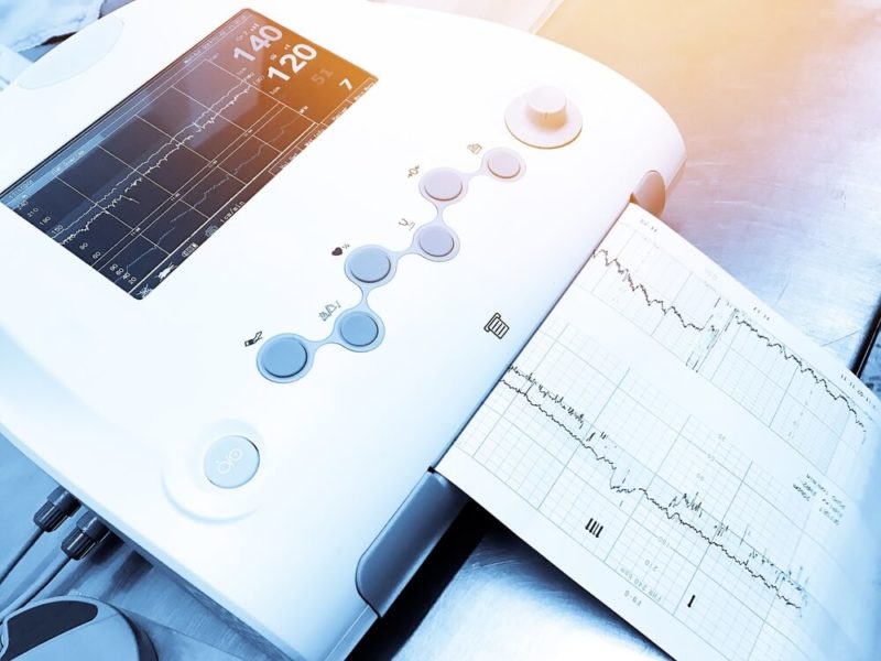 Everything You Should Know About Fetal Monitoring & EFM | Steven Novac MD