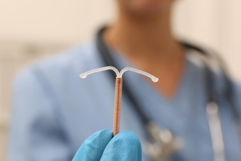 What is a Hormonal IUD? | Steven Novac MD