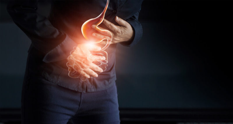 Different Types of Colon Cancer | Omar Rashid, Medicus Elite