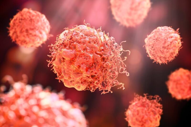 Sarcoma: Types, Causes, Risk Factors, and Treatment | Omar Rashid ...