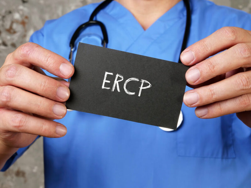 ERCP (Endoscopic Retrograde Cholangiopancreatography): All You Need to ...