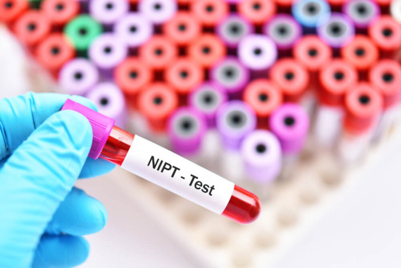 NIPT Test: What Does NIPT Test For? | Trogolo Obstetrics and Gynecology