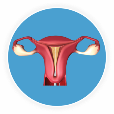 NovaSure Endometrial Ablation In Miramar, Fl | Women's Health of South ...